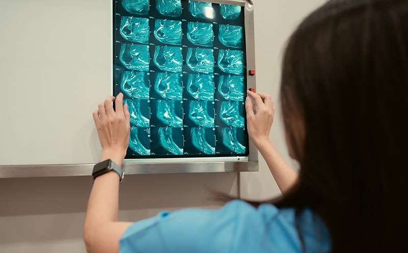 Cancer Prevention and Screening | MCW Cancer Center | Medical College ...